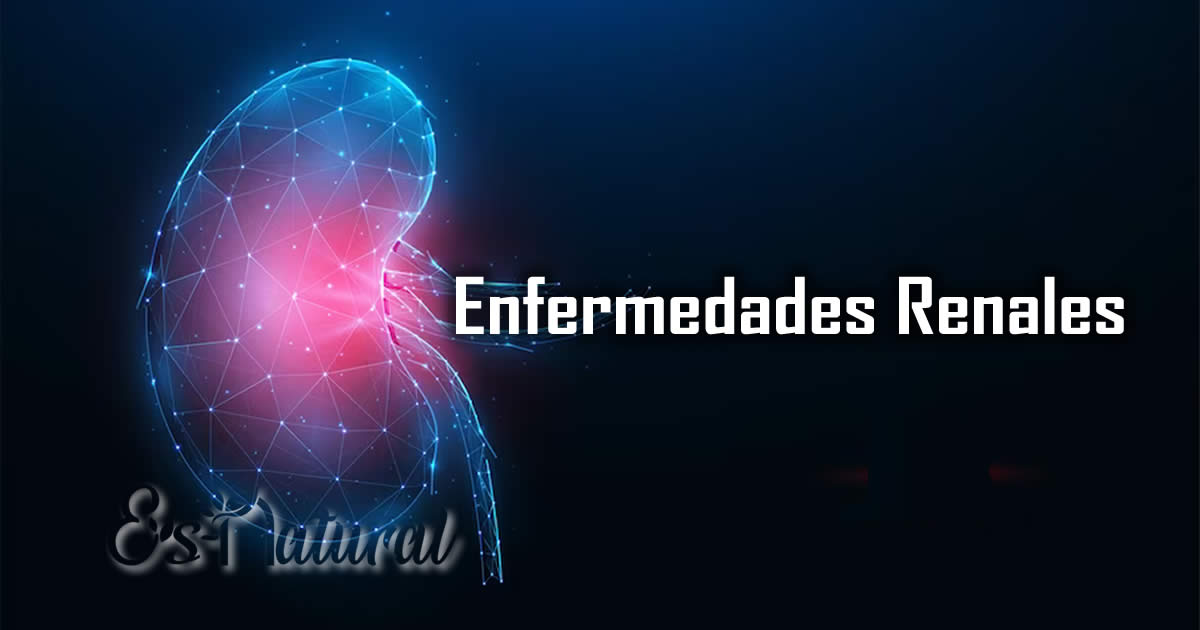 Problemas Renales Frecuentes, Causas, Síntomas y Plantas Auxiliares ...